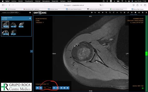 Web Viewer User General Orthanc Users