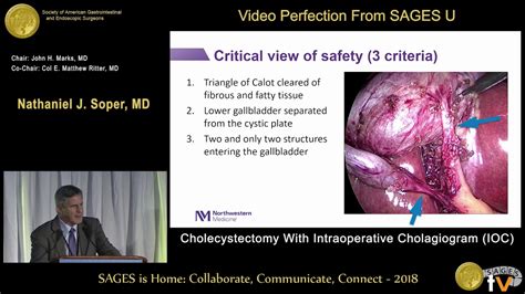 Laparoscopic Cholecystectomy Critical View
