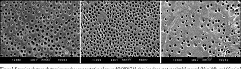 Figure 1 From Influence Of Apical Preparation Size On Effective