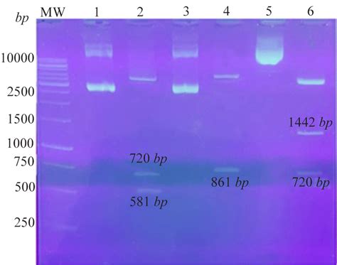 Confirmation Of The Recombinant Plasmids Using Digestion Lane 1