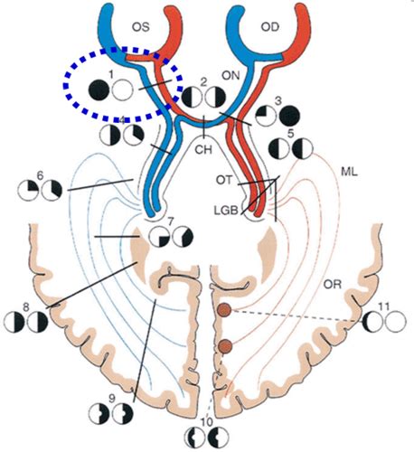 Visual Pathway Part 2 Flashcards Quizlet