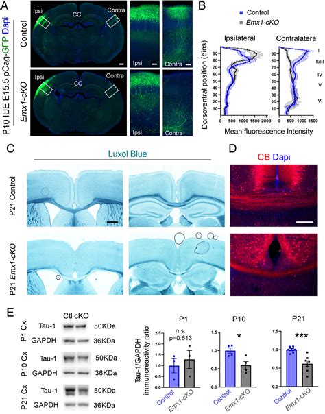 Kif2a Deficiency Causes Early Onset Neurodegeneration Pnas