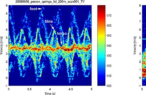 Figure 6 From Millimeter Wave Radar Micro Doppler Signatures Of Human Motion Semantic Scholar