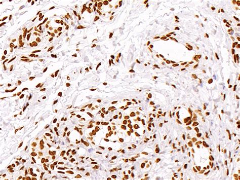 免疫组织化学ihc 四川赛因斯特生物科技有限公司