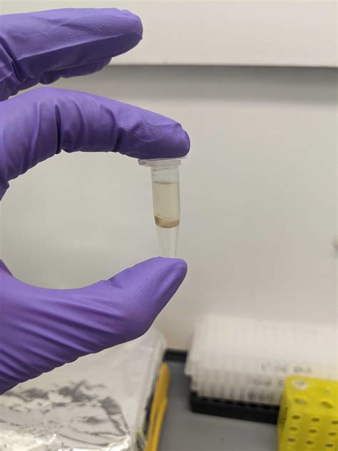 20210622 Lipid Assay Trial Kevin H Wongs Open Lab Notebook