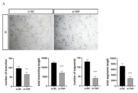 Biomedicines Free Full Text Inactivation Of Yes Associated Protein