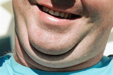How To Get Rid Of Double Chin