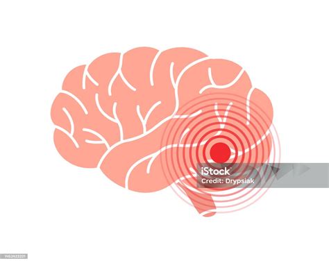 인간의 뇌 통증 기호입니다 뇌통 아이콘입니다 벡터 그림입니다 인체 통증 통증 점 지력에 대한 스톡 벡터 아트 및 기타 이미지 지력 아이콘 사람 뇌 Istock