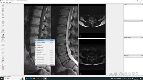 深度学习标注软件labelme的使用 知乎