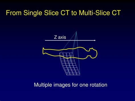 Ppt การกำหนดคุณลักษณะเครื่อง Ct Scan Powerpoint Presentation Id3726708