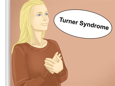 Turners Syndrome Occurrence At Jonathan Pitcher Blog