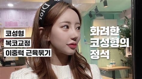 코성형 이중턱근육묶기 2주차 전후 성형 브이로그 Youtube