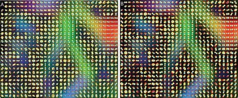 Diffusion Weighted Imaging Analysis Radiology Key