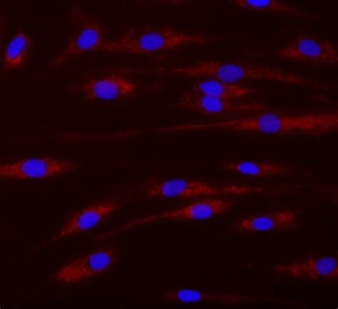 Tmrm Assay Kit Mitochondrial Membrane Potential Ab228569 Abcam