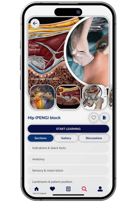 NYSORA Nerve Blocks App New Design Ultrasound Guided Nerve Blocks