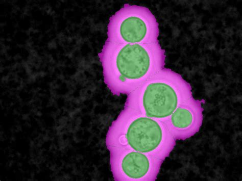Cryptococcus Neoformans