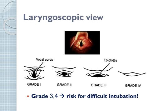 Ppt Airway Intubation Powerpoint Presentation Free Download Id 2894259