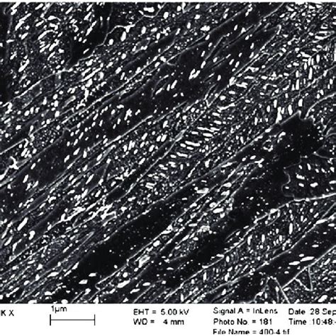 Typical Microstructure Of The Lower Bainite With Carbides Download Scientific Diagram