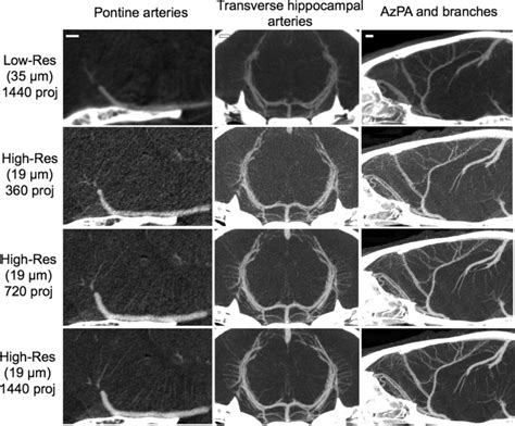 effect of spatial resolution voxel size and projection number on
