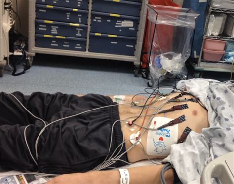 Ekg And Defib Pads On Male Chest In 2025 Sick Boy Nurse Skills