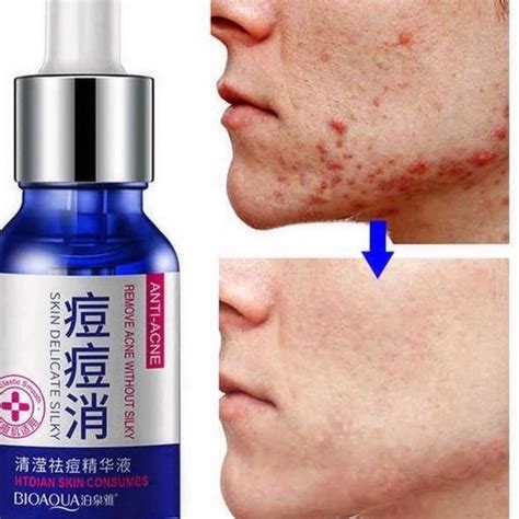 سرم ضد جوش اورژانسی بیواکوا بانوی من