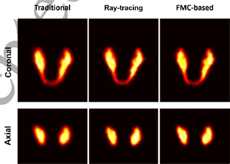 Experimental Mouse Thyroid Scan With 123 I To Compare The Fmc Based Download Scientific Diagram
