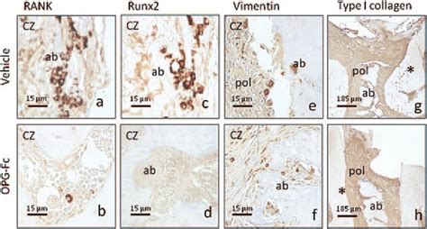 Immunohistochemical Detection Of Receptor Activator Of Nuclear Factor