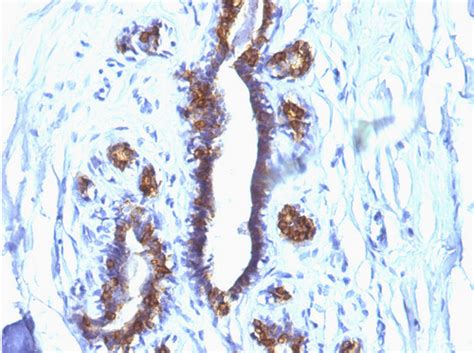 Am50140pu T Ema Muc1 Mouse Monoclonal Antibody Clone Id Spm132