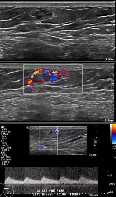 Case Vascular Abnormalities Radiology Ucla Health