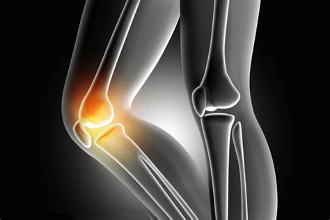 Sciatica Knee Pain Causes Symptoms And Treatments