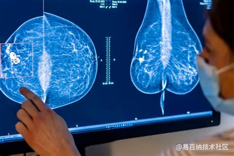 谷歌与医疗技术公司合作开发人工智能乳腺癌筛查工具 专栏 易百纳技术社区