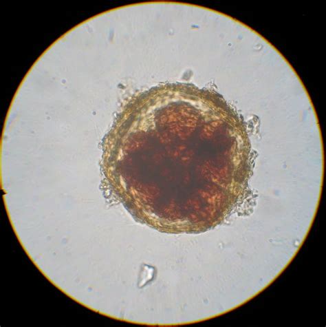 217 Questions With Answers In Morphology Science Topic