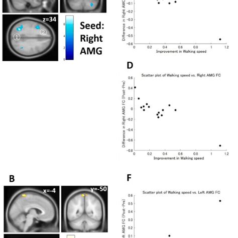 Functional Connectivity Fc Correlated With Walking Speed A Fc Download Scientific Diagram