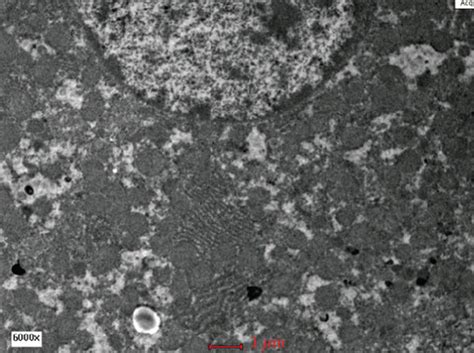 A Electron Micrograph Showing The Hepatocyte Of The Sham Group Download Scientific Diagram