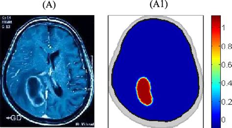 Figure 4 From A Fully Decoupled Discontinuous Galerkin Approximation Of The Cahn Hilliard