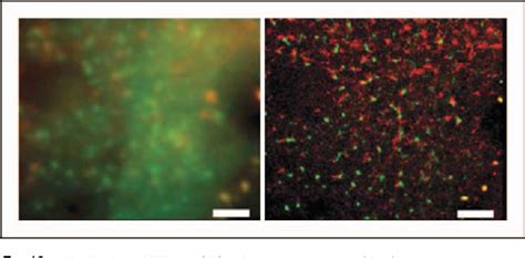 Figure 1 From Review Of Super Resolution Fluorescence Microscopy For