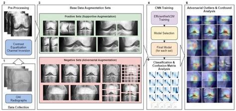New Paper On Base Data Augmentation Methods For Knee Joint Osteoarthritis Algorithms Mdpi