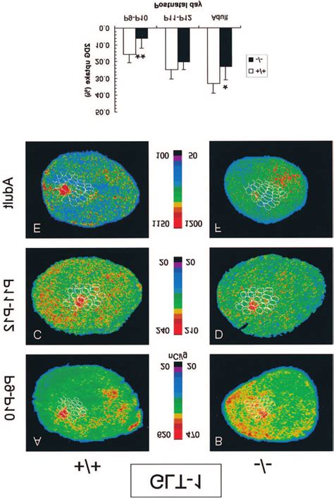 Effect Of C1c2 Whisker Stimulation On 2 Dg Uptake In Somatosensory Download Scientific Diagram