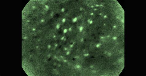 Bearstech Sur Linkedin Designing An Open Source Microscope