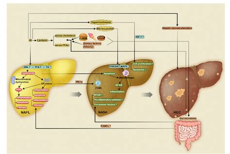 Figure 1 From The Pathogenesis Of Hcc Driven By Nash And The Preventive