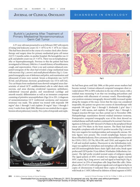 Pdf Burkitts Leukemia After Treatment Of Primary Mediastinal