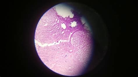 Schematic Diagram Of Mammals Ovary Under Microscope B Sc