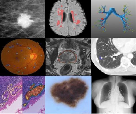Medical Imaging Applications In Which Deep Learning Has Achieved Download Scientific Diagram