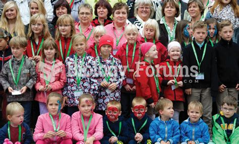 Acromegaly In One Individual From A Pair Of Identical Twins Biology Forums Gallery