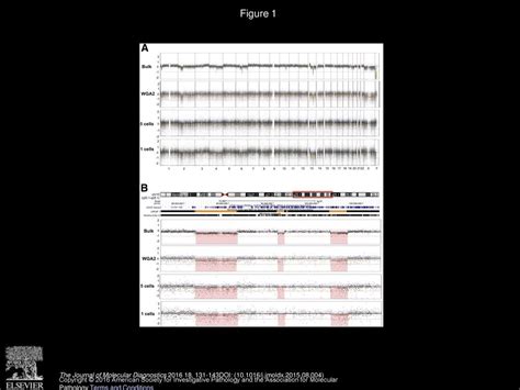 High Resolution Genomic Profiling Of Disseminated Tumor Cells In