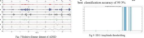 Figure 2 From Neurological Disorder Detection Using Eeg Signal Processing And Machine Learning