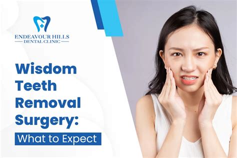 Wisdom Teeth Removal Surgery What To Expect
