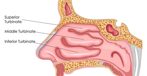 Turbinoplasty Otorhinolaryngology Ear Nose Throat