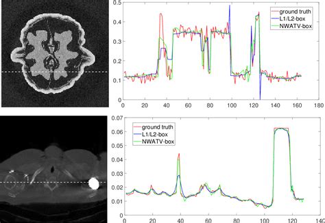 Figure 1 From Sparse View X Ray Ct Based On A Box Constrained Nonlinear Weighted Anisotropic Tv