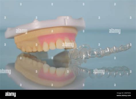 Occlusal Splint Hi Res Stock Photography And Images Alamy